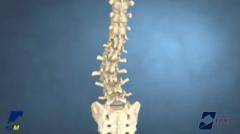 Spine Surgery Videos | Spine Surgical Implants Distribution Southern ...
